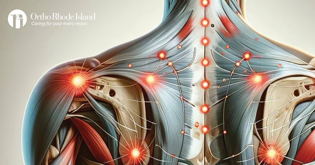 TRIGGER POINT INJECTIONS – Ortho Rhode Island